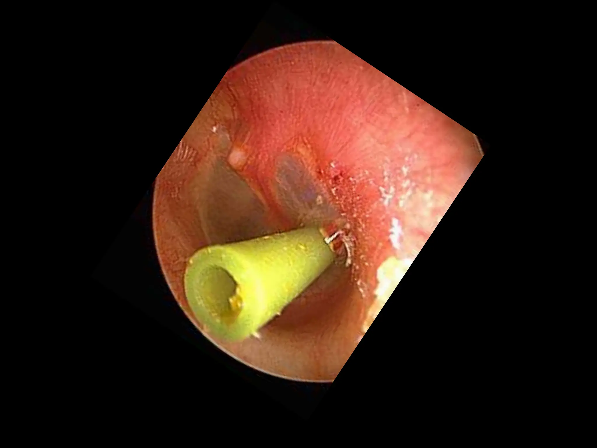 Ears, anatomy and otoscopic pathology, pictures and diagrams.ppt