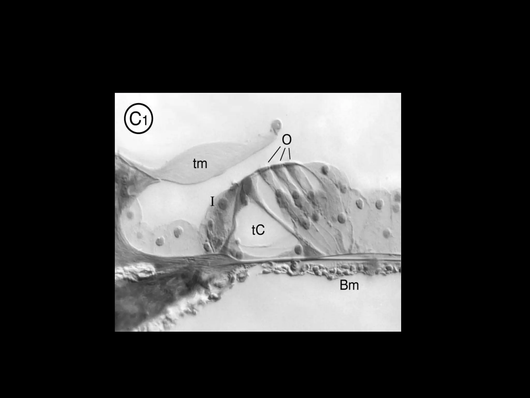 Ears, anatomy and otoscopic pathology, pictures and diagrams.ppt