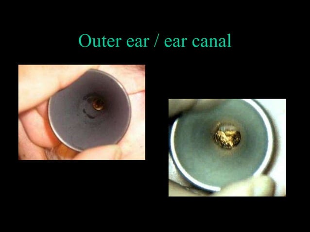 Ears, anatomy and otoscopic pathology, pictures and diagrams.ppt