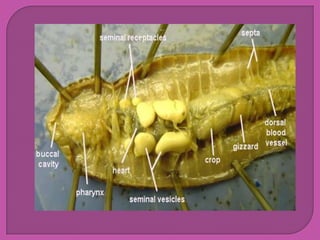 Oligochaeta Dissection