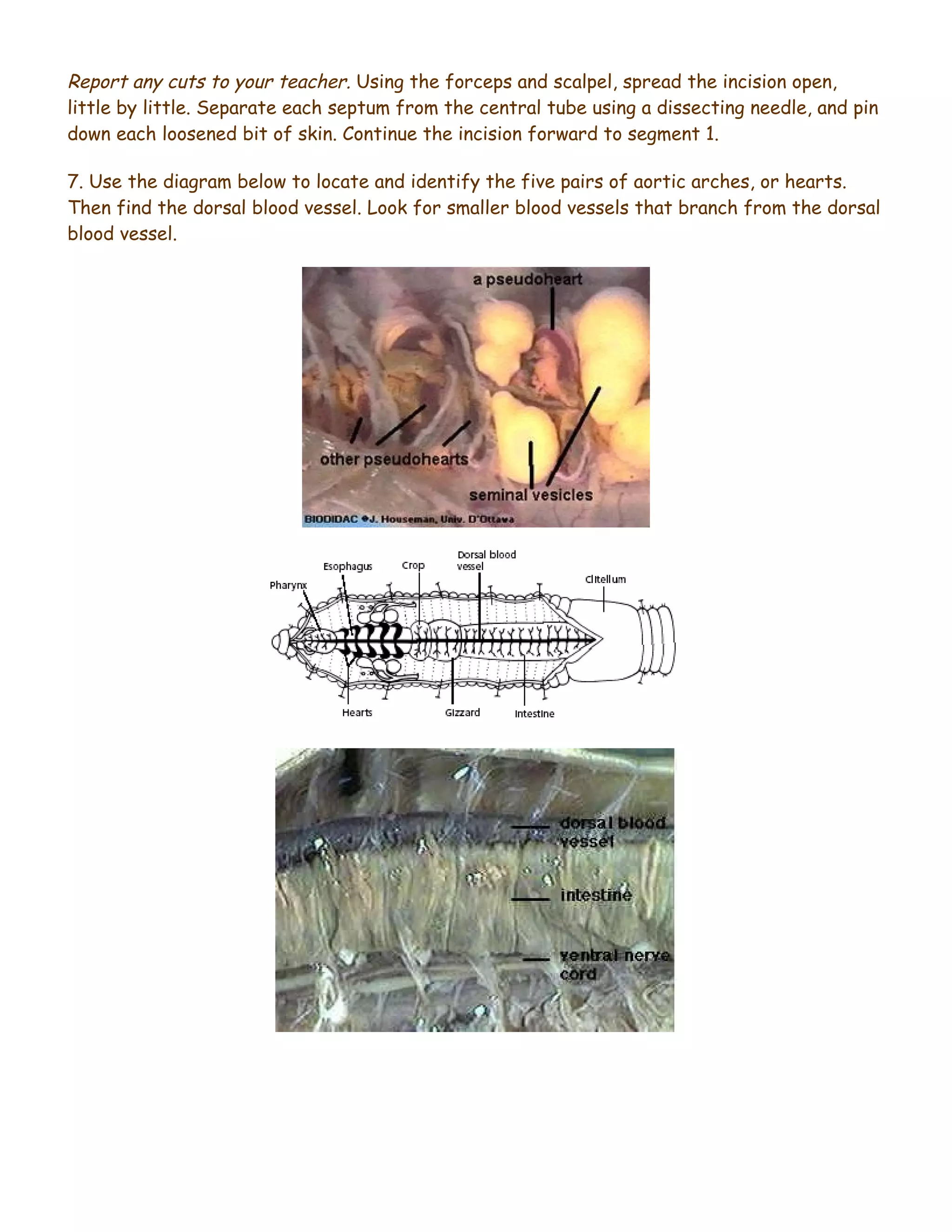 Earthworm Dissection | PDF