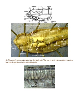 Earthworm Dissection | DOC