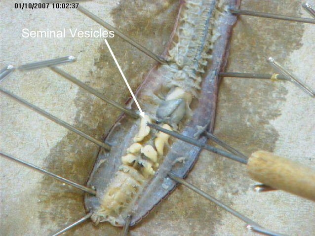 Earthworm dissection 001 | PPT