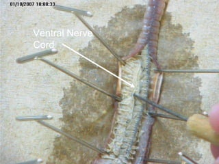 Earthworm dissection 001 | PPT