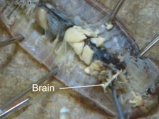 Earthworm Dissection Brain