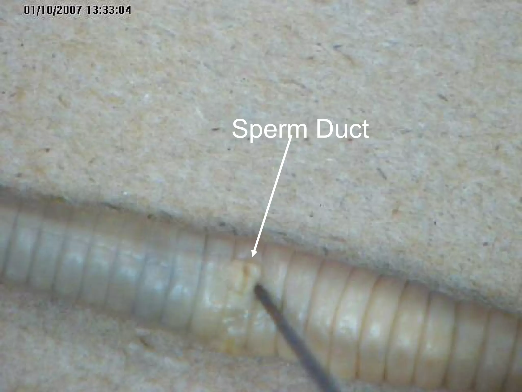 Earthworm dissection 001 | PPT