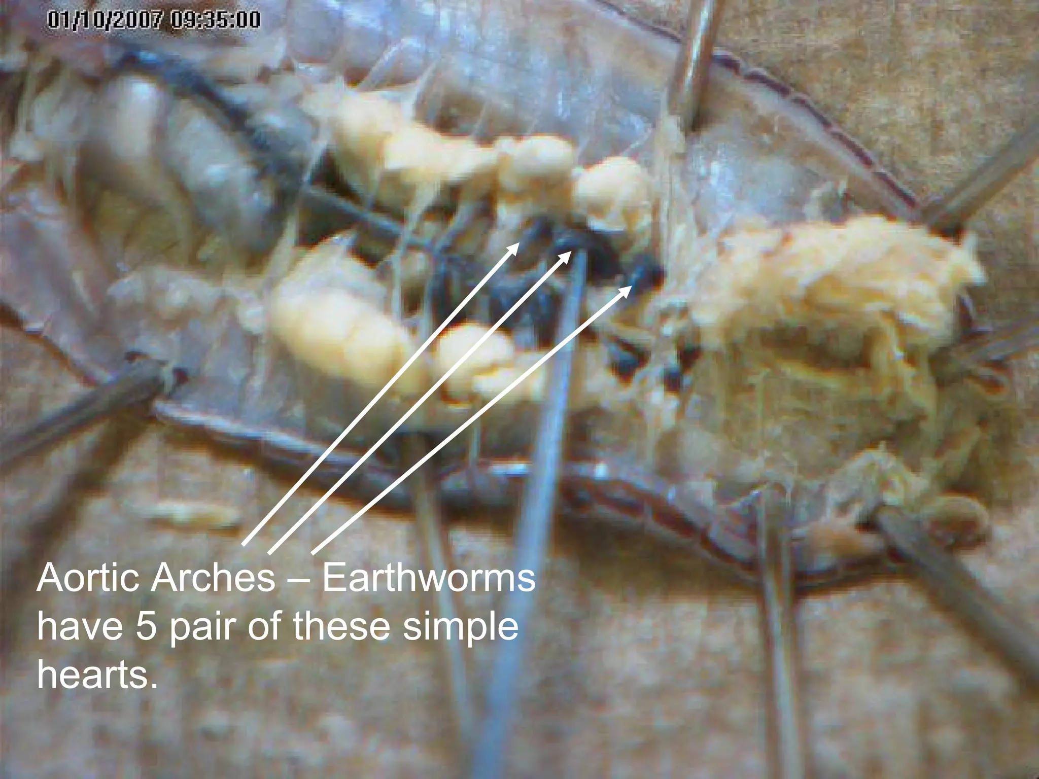 Earthworm dissection 001 | PPT