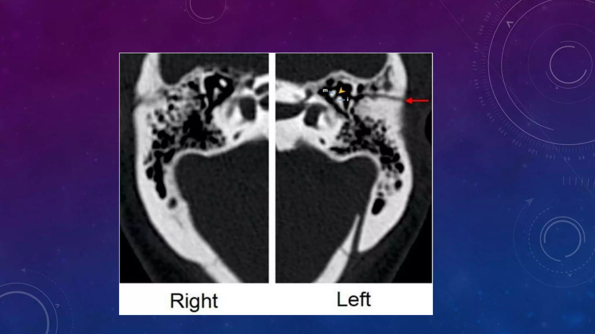 Ear trauma | PPTX
