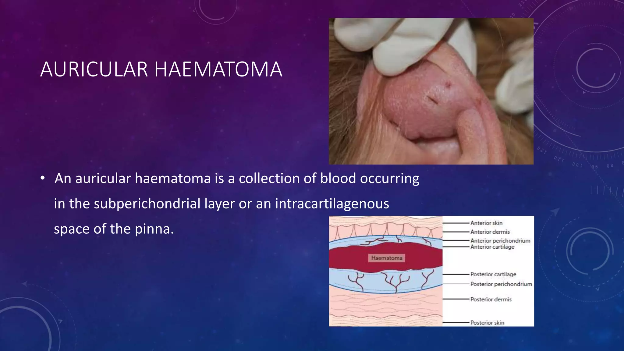 Ear trauma | PPTX