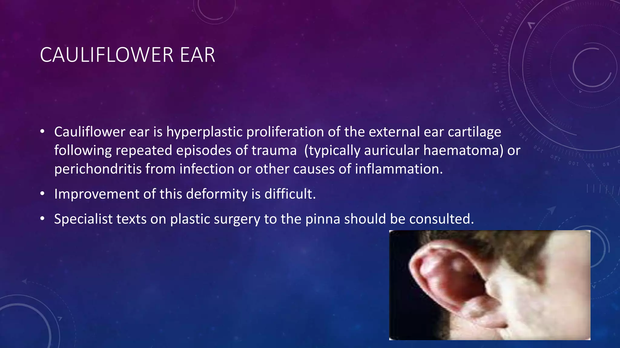 Ear trauma | PPTX