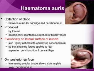 ear trauma, applied aspect and management.pptx