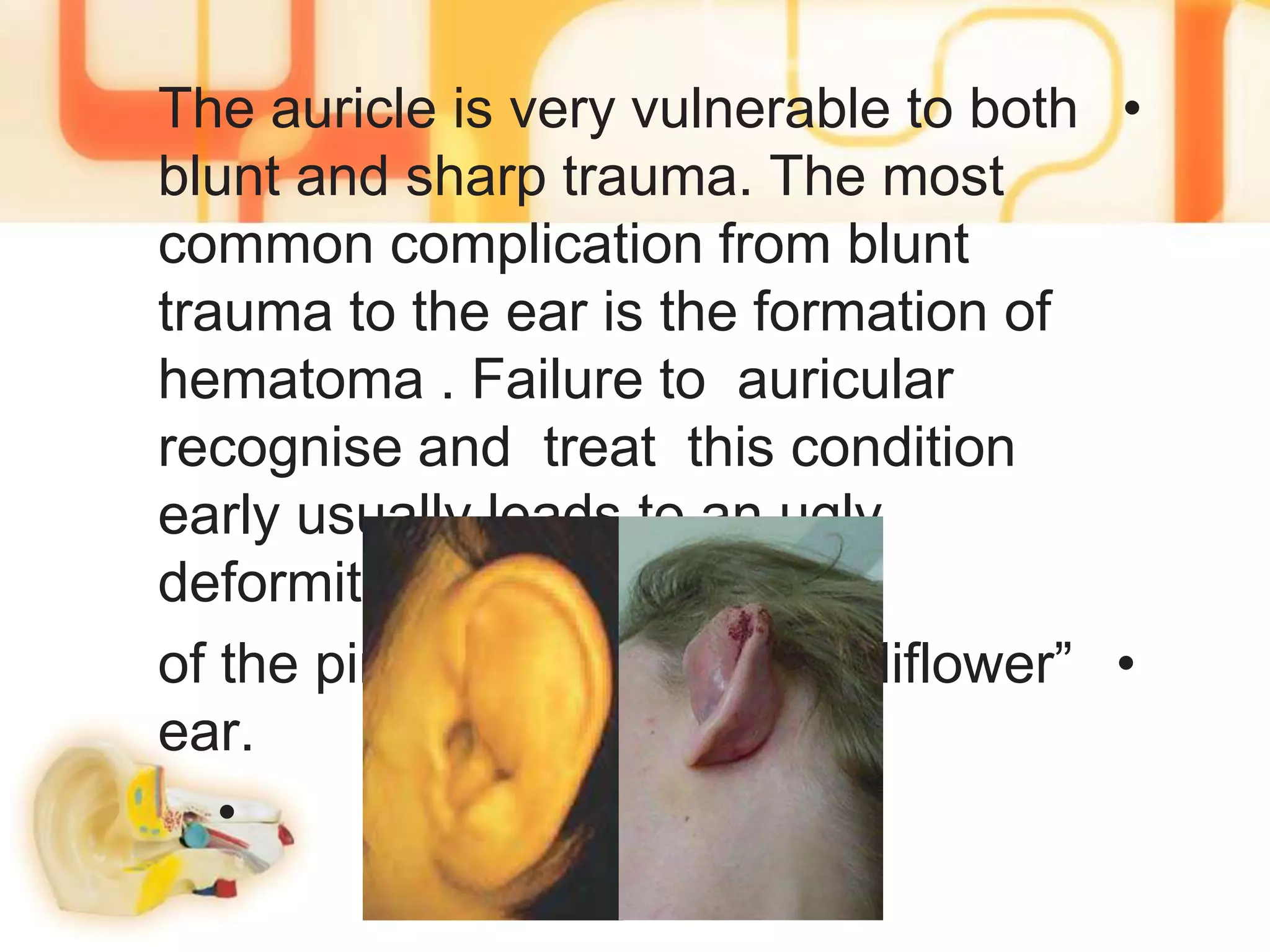 Ear trauma | PPTX