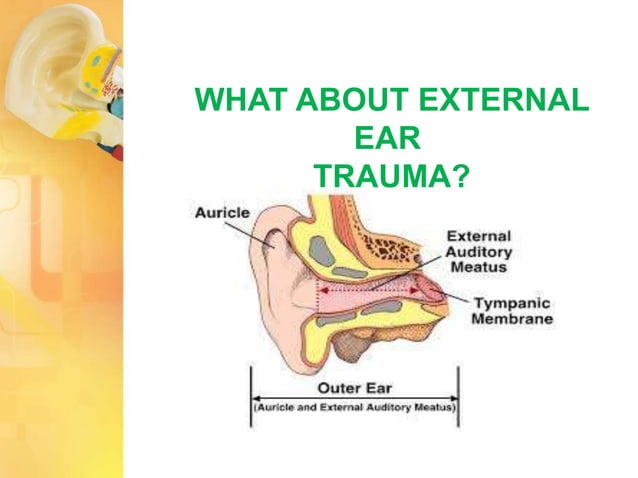 Ear trauma | PPTX | Death, Injury, or Military Conflict | Sensitive Topics