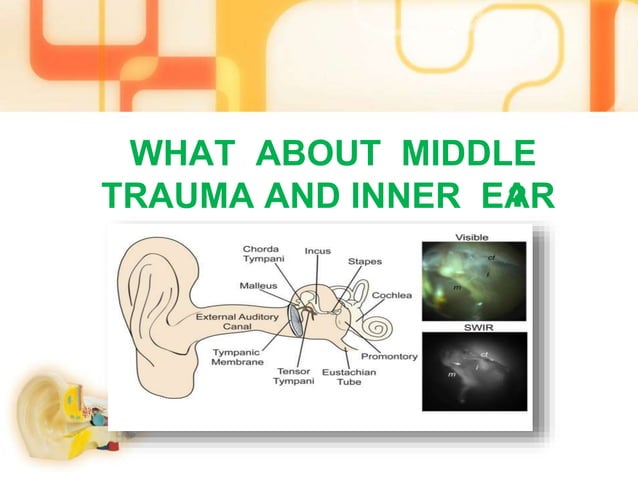 Ear trauma | PPTX | Death, Injury, or Military Conflict | Sensitive Topics