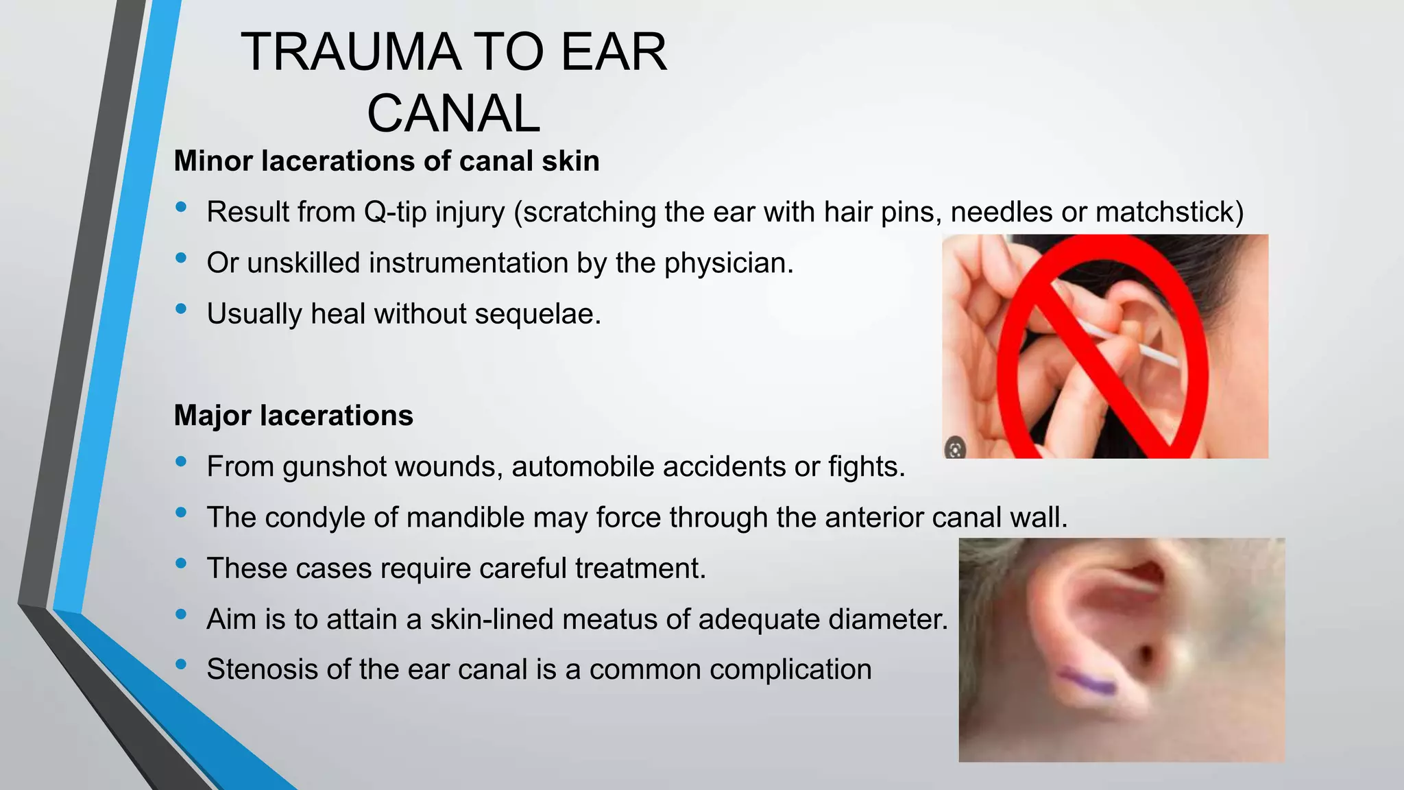 EAR TRAUMA AND FOREIGN BODY.pptx