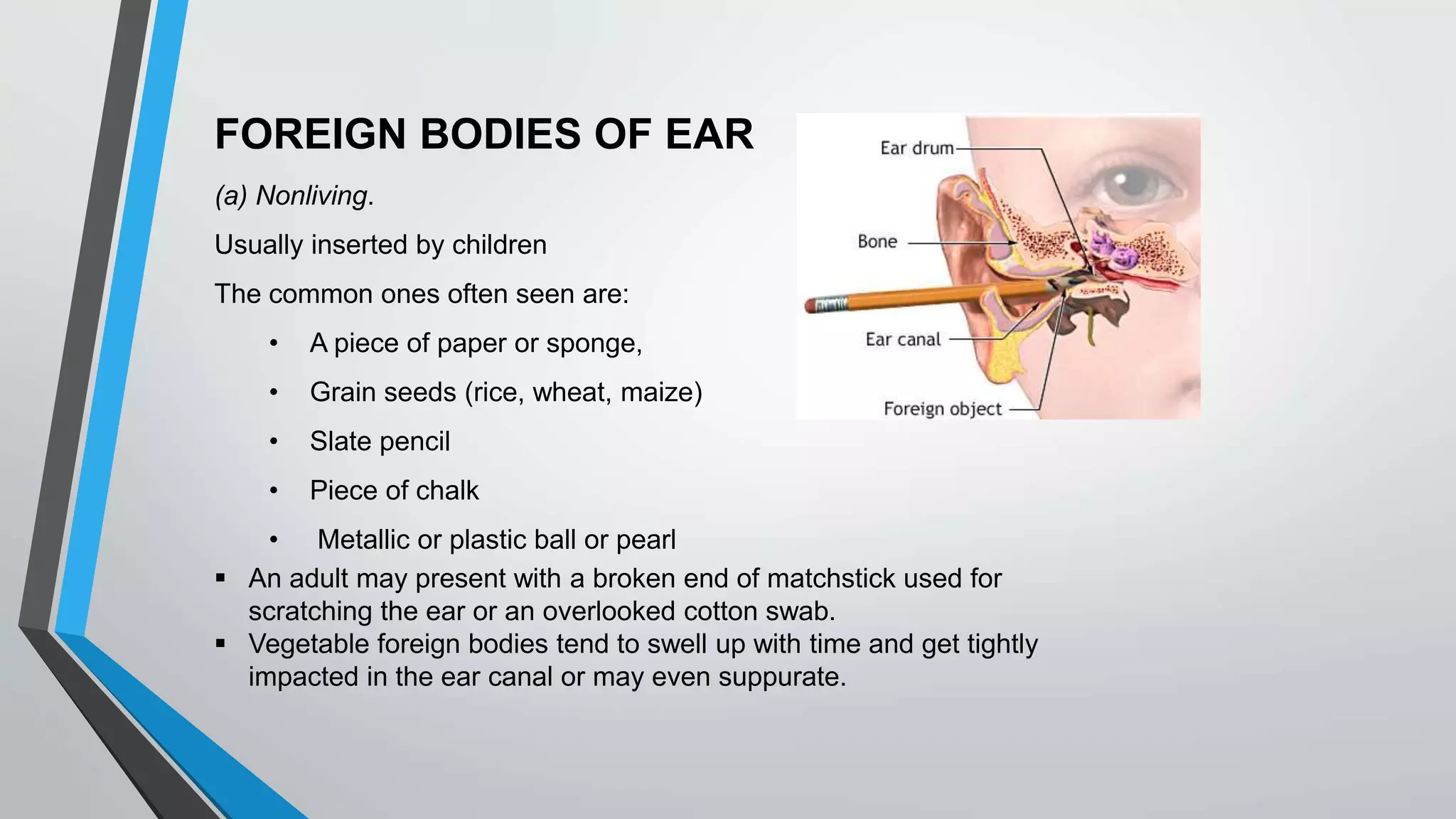 EAR TRAUMA AND FOREIGN BODY.pptx