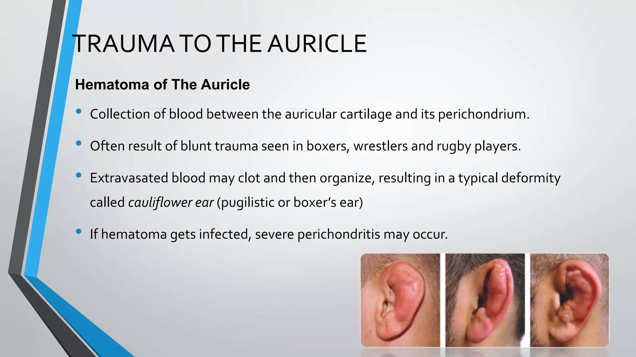 EAR TRAUMA AND FOREIGN BODY.pptx