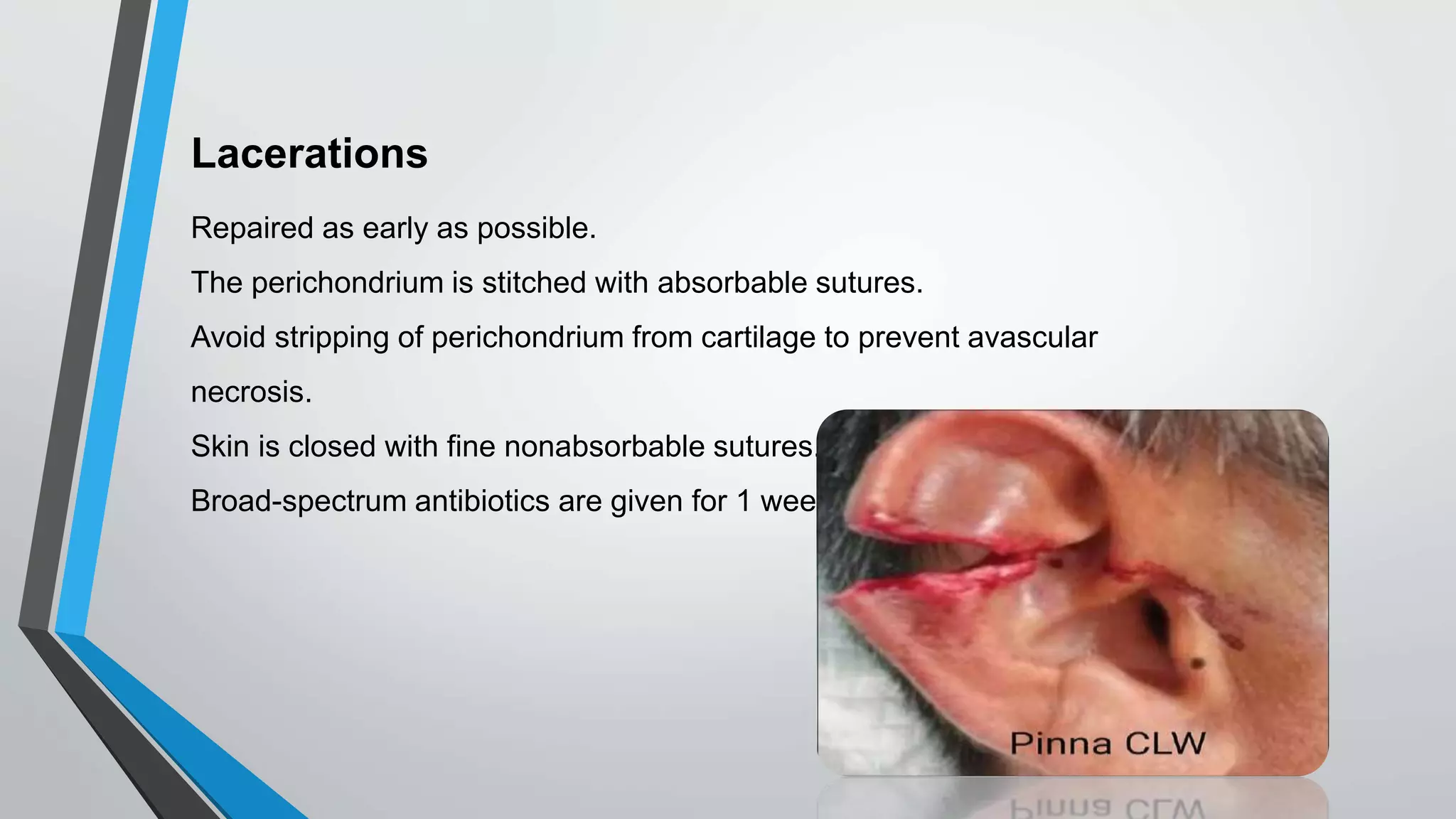 EAR TRAUMA AND FOREIGN BODY.pptx