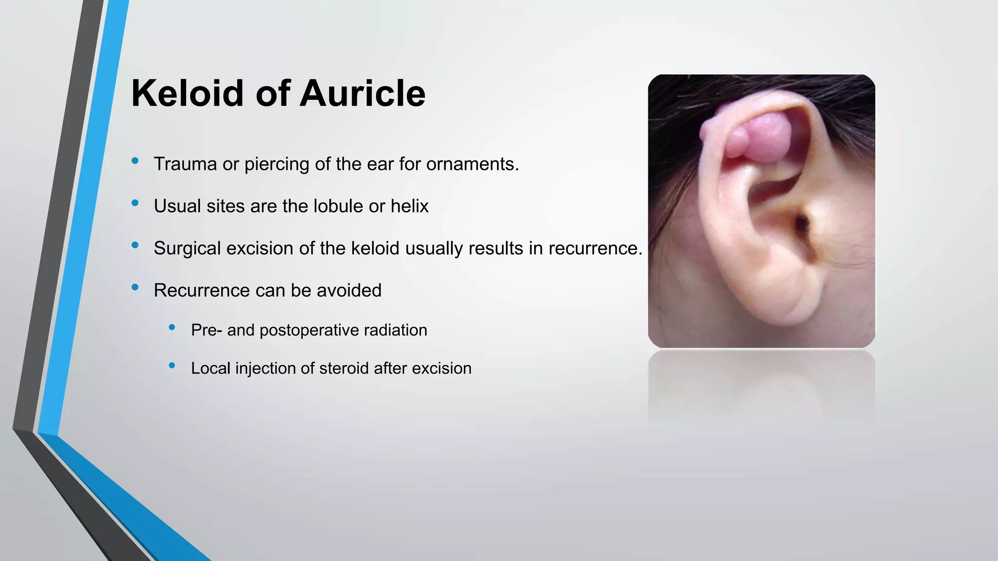 EAR TRAUMA AND FOREIGN BODY.pptx