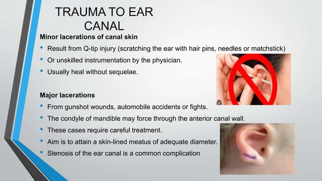 EAR TRAUMA AND FOREIGN BODY.pptx