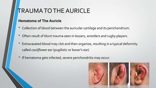 EAR TRAUMA AND FOREIGN BODY.pptx