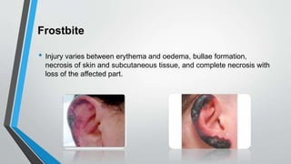 EAR TRAUMA AND FOREIGN BODY.pptx