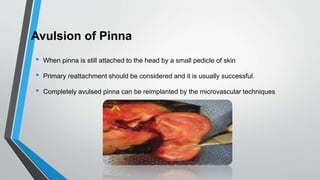EAR TRAUMA AND FOREIGN BODY.pptx