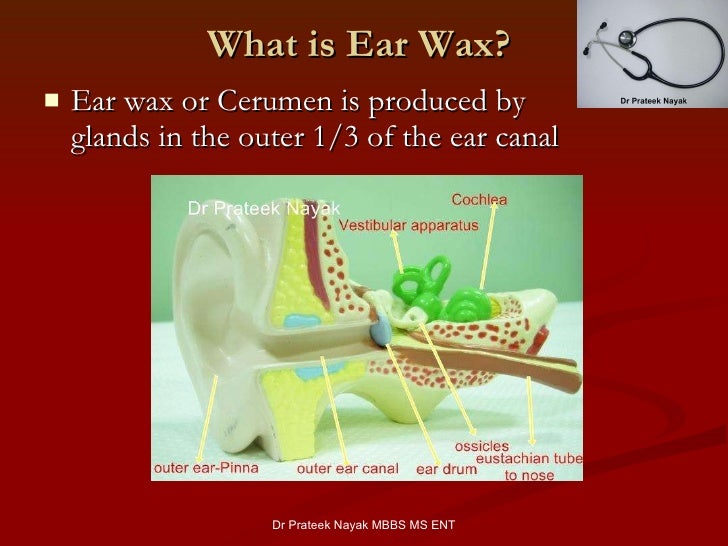 Ear Wax - by ENT Specialist Bangalore Dr Prateek Nayak Ear Wax - by ENT Specialist Bangalore Dr Prateek Nayak