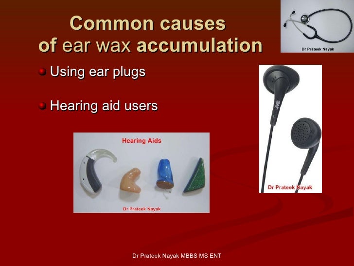 Ear Wax - by ENT Specialist Bangalore Dr Prateek Nayak Ear Wax - by ENT Specialist Bangalore Dr Prateek Nayak