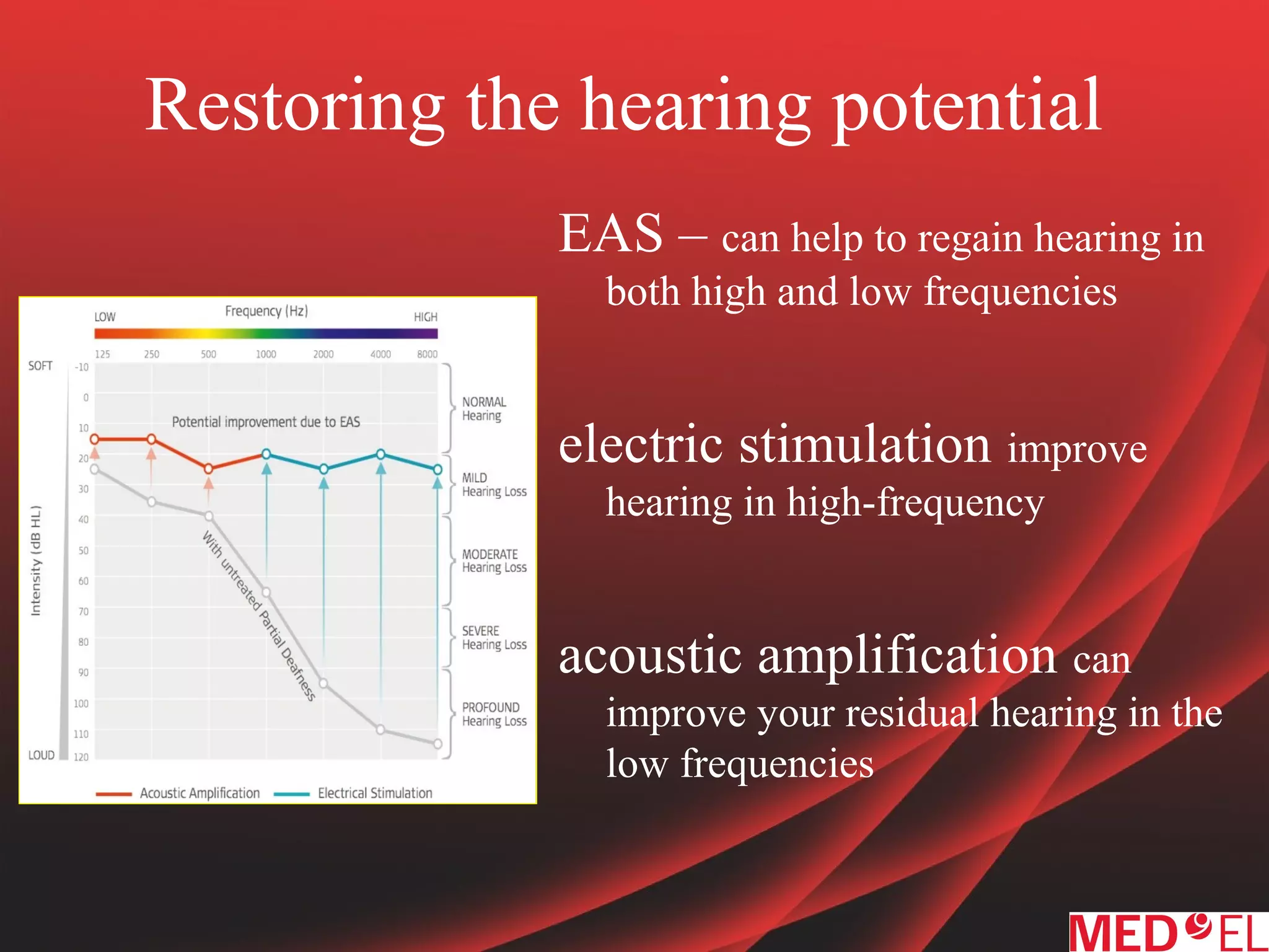 Electro Acoustic Stimulation ( EAS ) | PPT