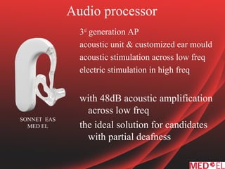 Electro Acoustic Stimulation ( EAS ) | PPT