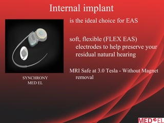 Electro Acoustic Stimulation ( EAS ) | PPT