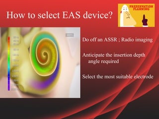 Electro Acoustic Stimulation ( EAS ) | PPT