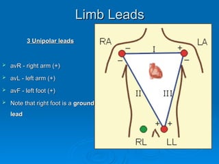 Easy to read ekg, how to read, how to representation | PPT