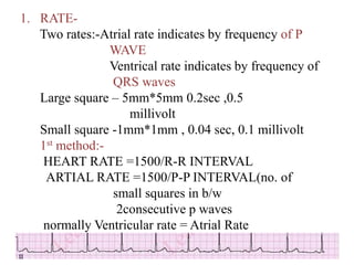 Easy ECG INTERPRETATION | PPTX