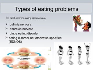 Eating problems | PPT