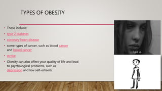 Eating fast food causes obesity | PPTX