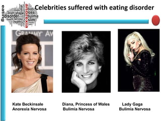 Bulimia Chipmunk Face