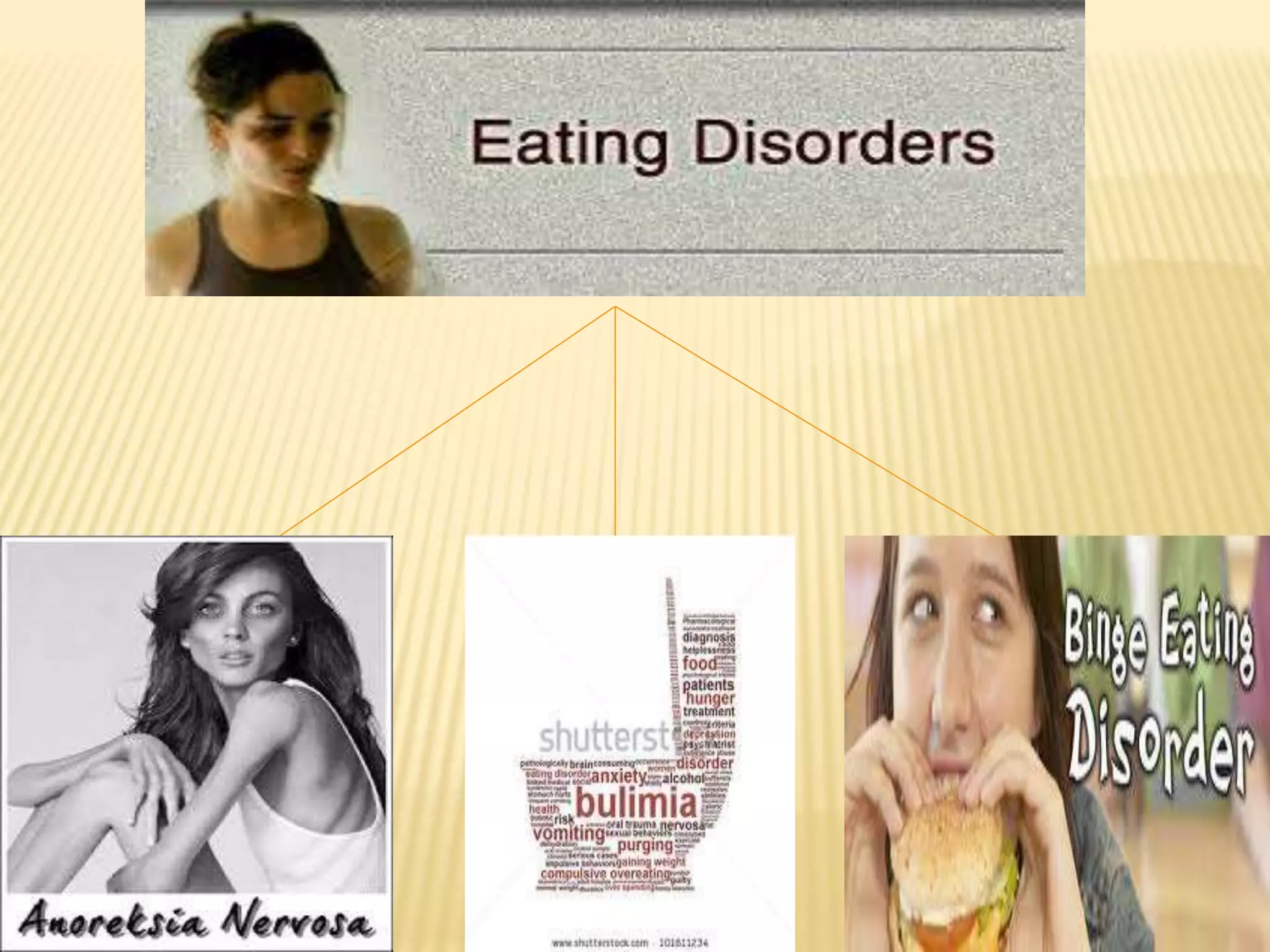 Eating disorder | PPTX