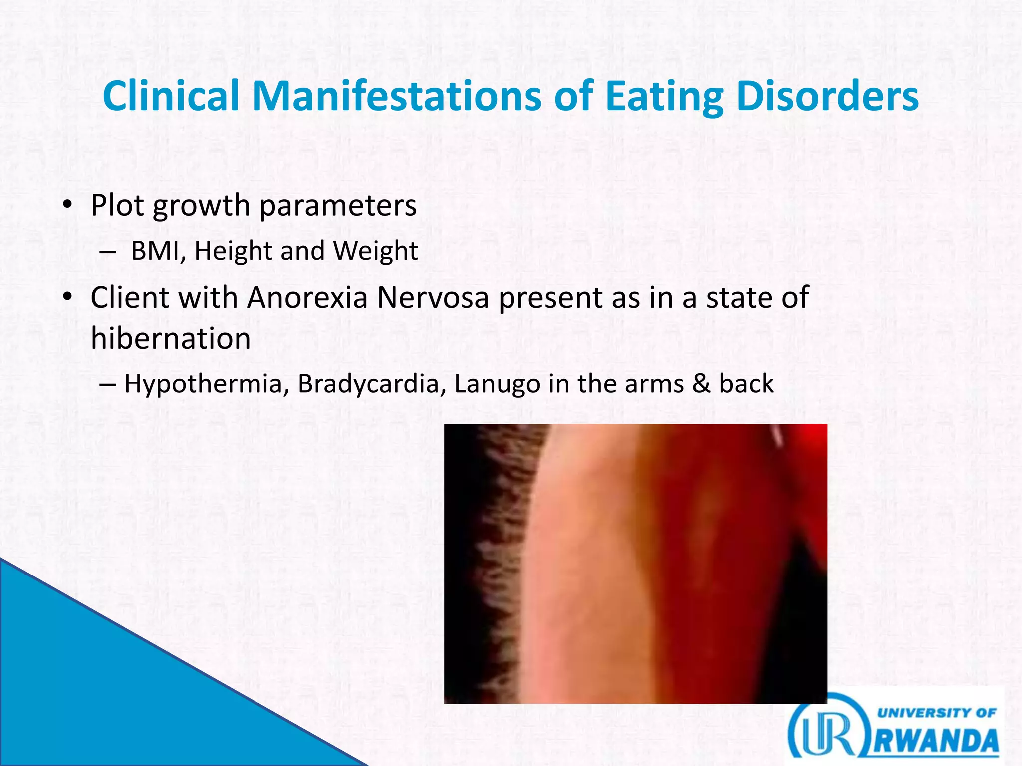 Eating disorder2019pptx 2 | PPTX