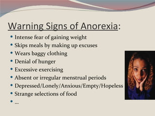 Eating disorders | PPT