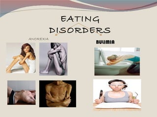 Eating disorders | PPT