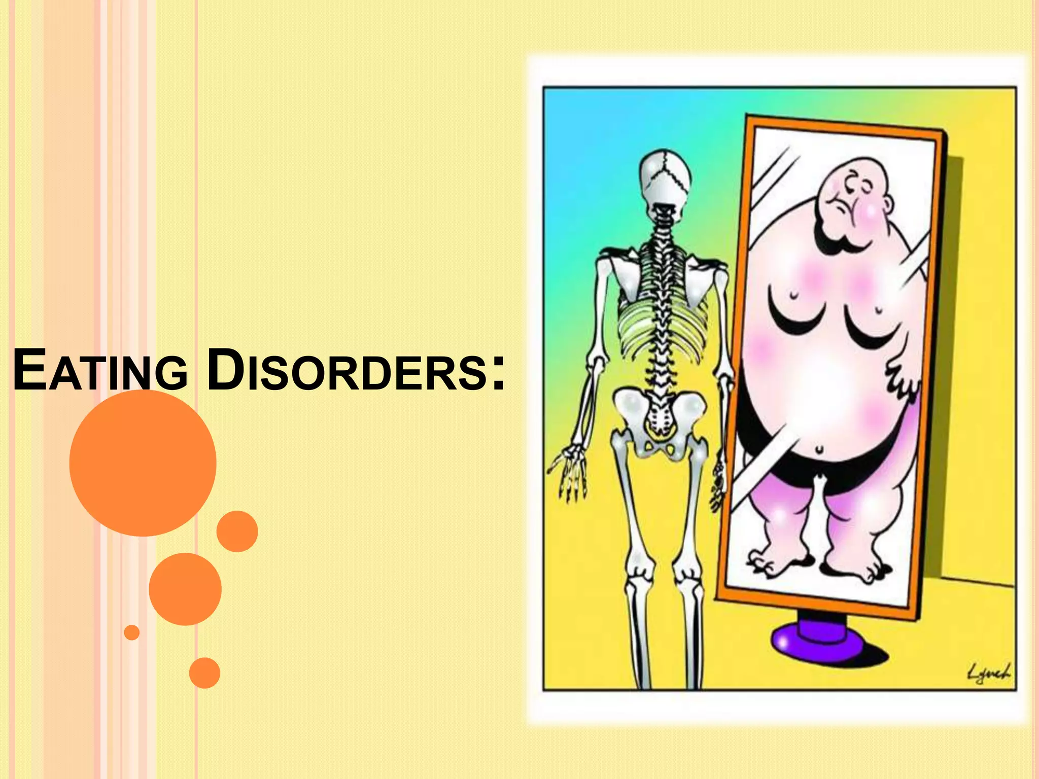 Eating disorders. | PPTX