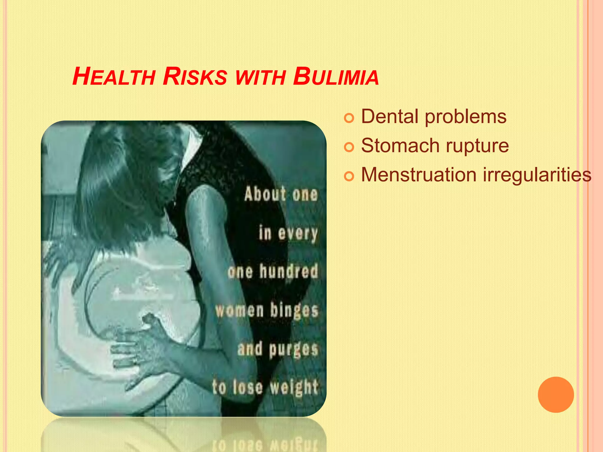 Eating disorders. | PPTX