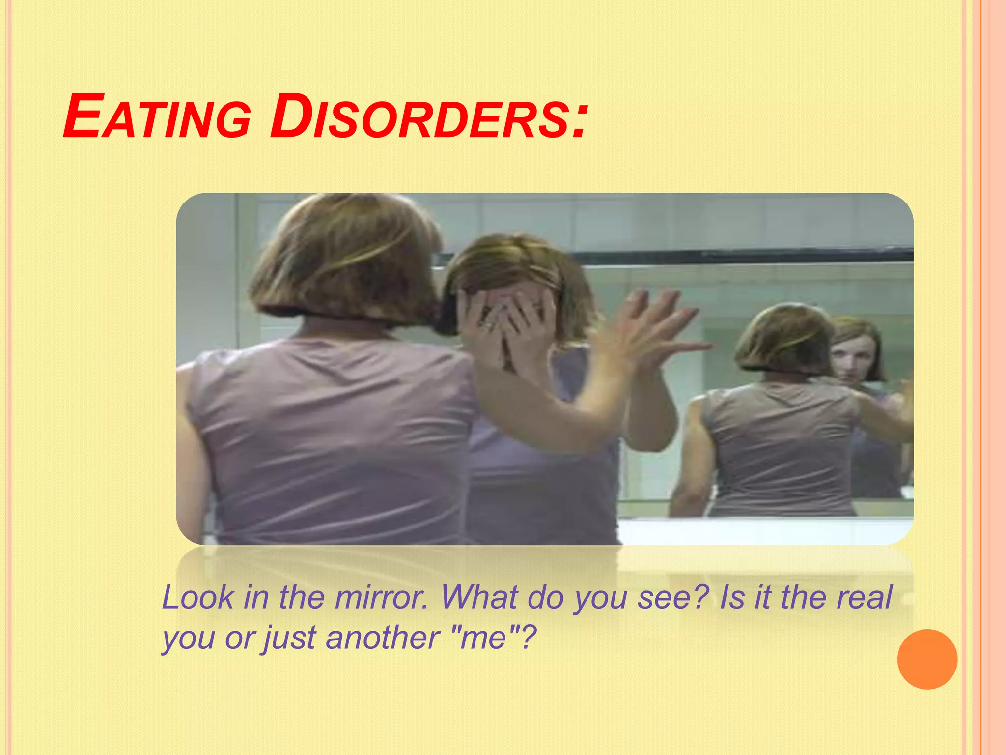 Eating disorders. | PPTX