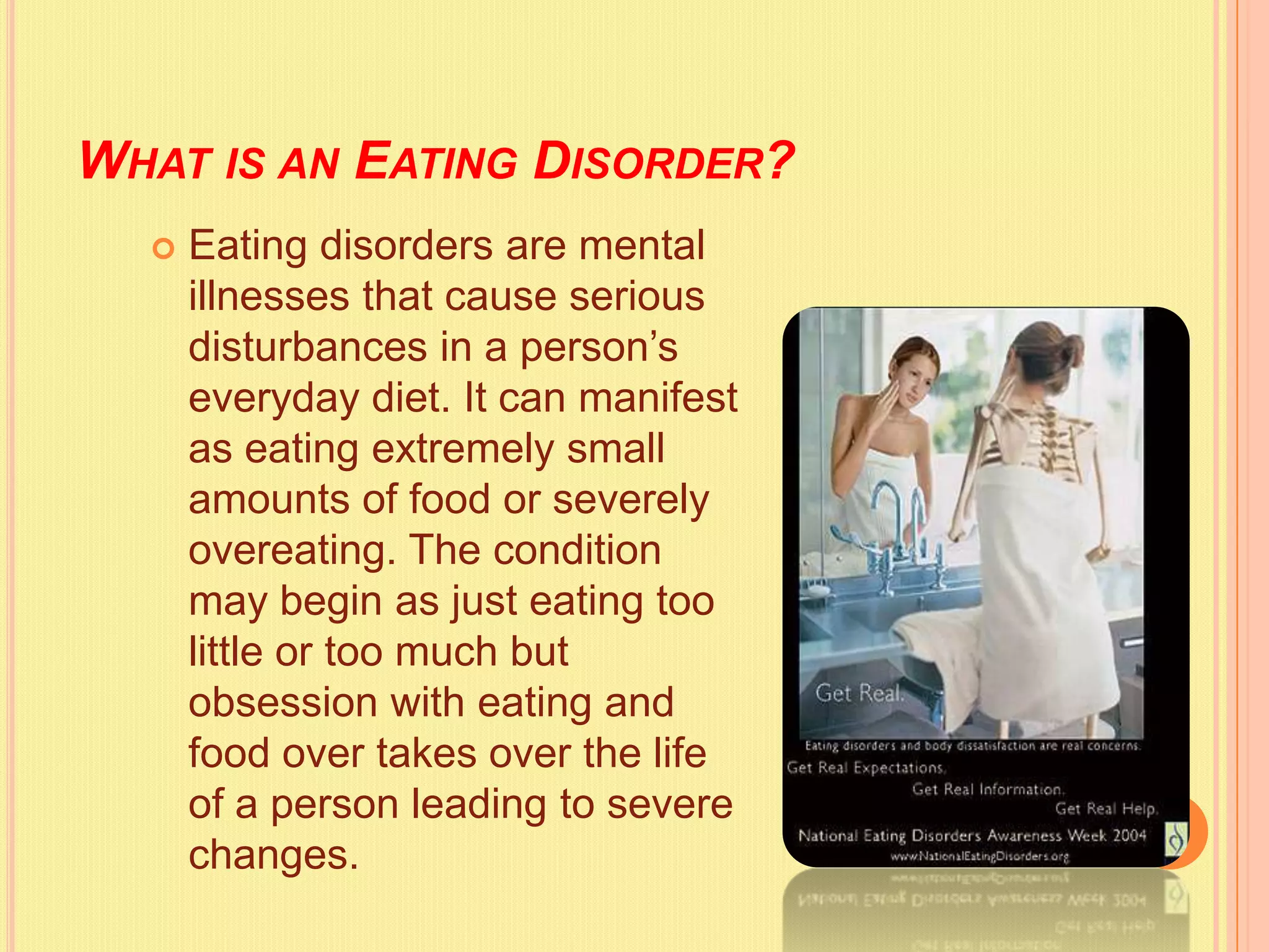 Eating disorders. | PPTX