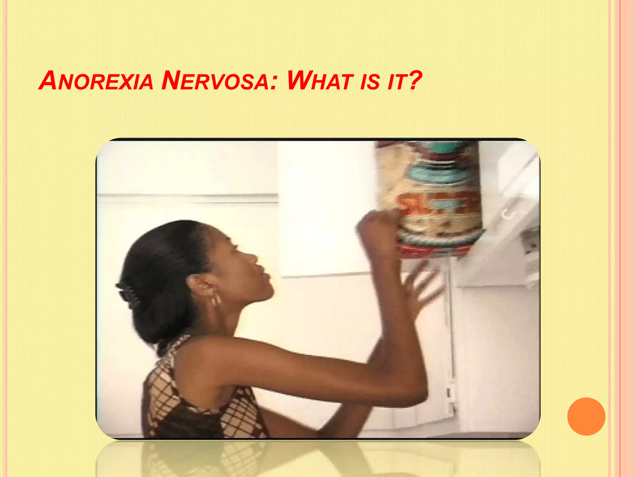 Eating disorders. | PPTX