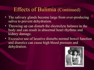 Eating disorders | PPT