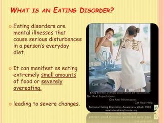 Eating Disorders Anorexia Nervosa Bulimia Nervosa Beinge Eating Pptx