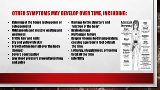 Eating disorders | PPTX